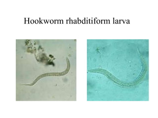 Ancylostoma Caninum Larvae