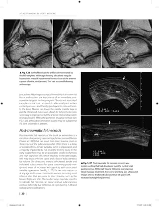 Atlas of Imaging in Sports Medicine | PDF