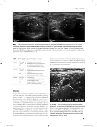 Atlas of Imaging in Sports Medicine | PDF