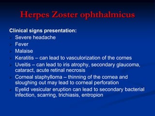 HIV/AIDS AND THE EYE DISORDERS IN ALL AGE GROUP | PPT