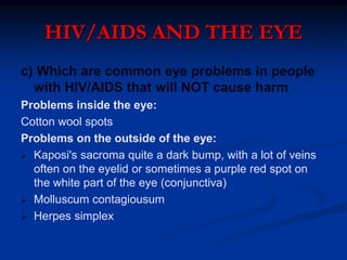 HIV/AIDS AND THE EYE DISORDERS IN ALL AGE GROUP | PPT