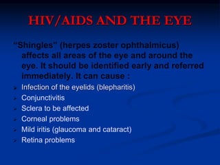 HIV/AIDS AND THE EYE DISORDERS IN ALL AGE GROUP | PPT