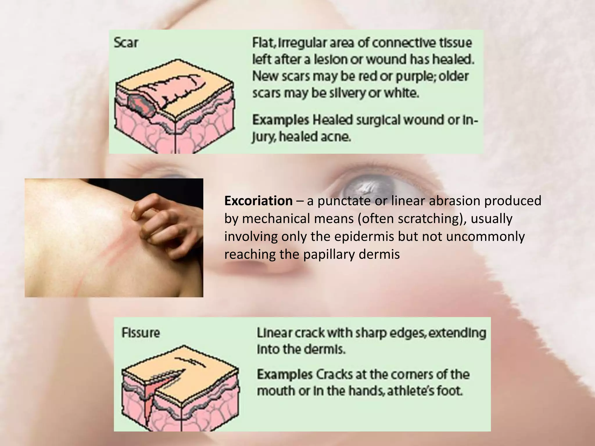 skin lesions | PPTX