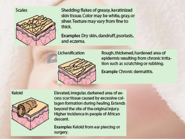 skin lesions