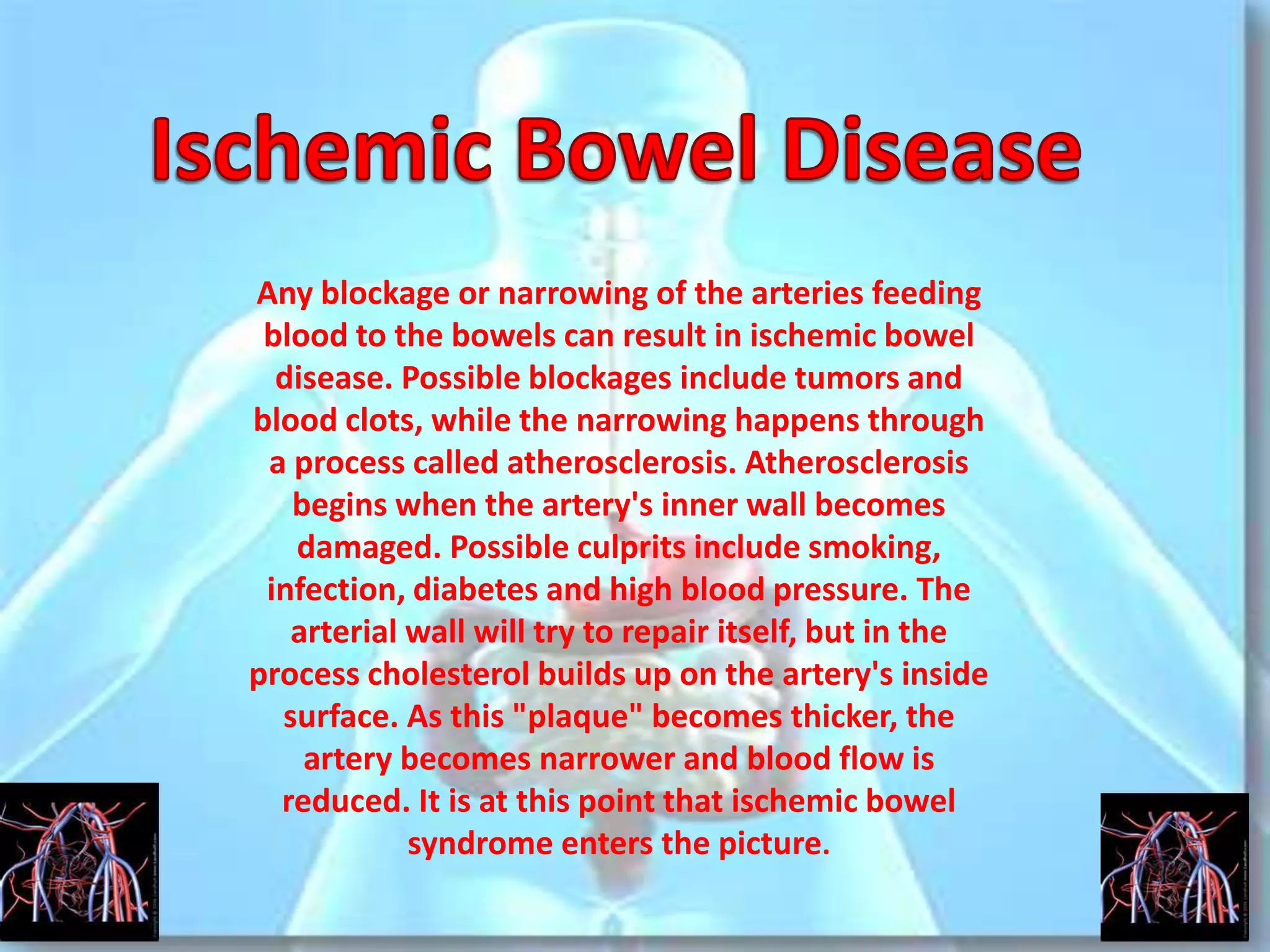 Gastrointestinal Tract Diseases | PPTX