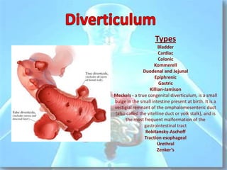 Gastrointestinal Tract Diseases | PPTX
