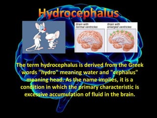 neuronal diseases | PPT