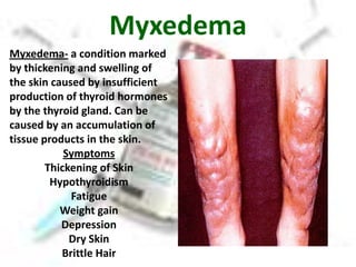 endocrine system | PPT