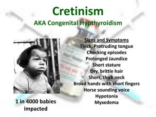 endocrine system | PPT