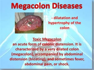 gi diseases | PPTX | Digestive Disorders | Diseases and Conditions