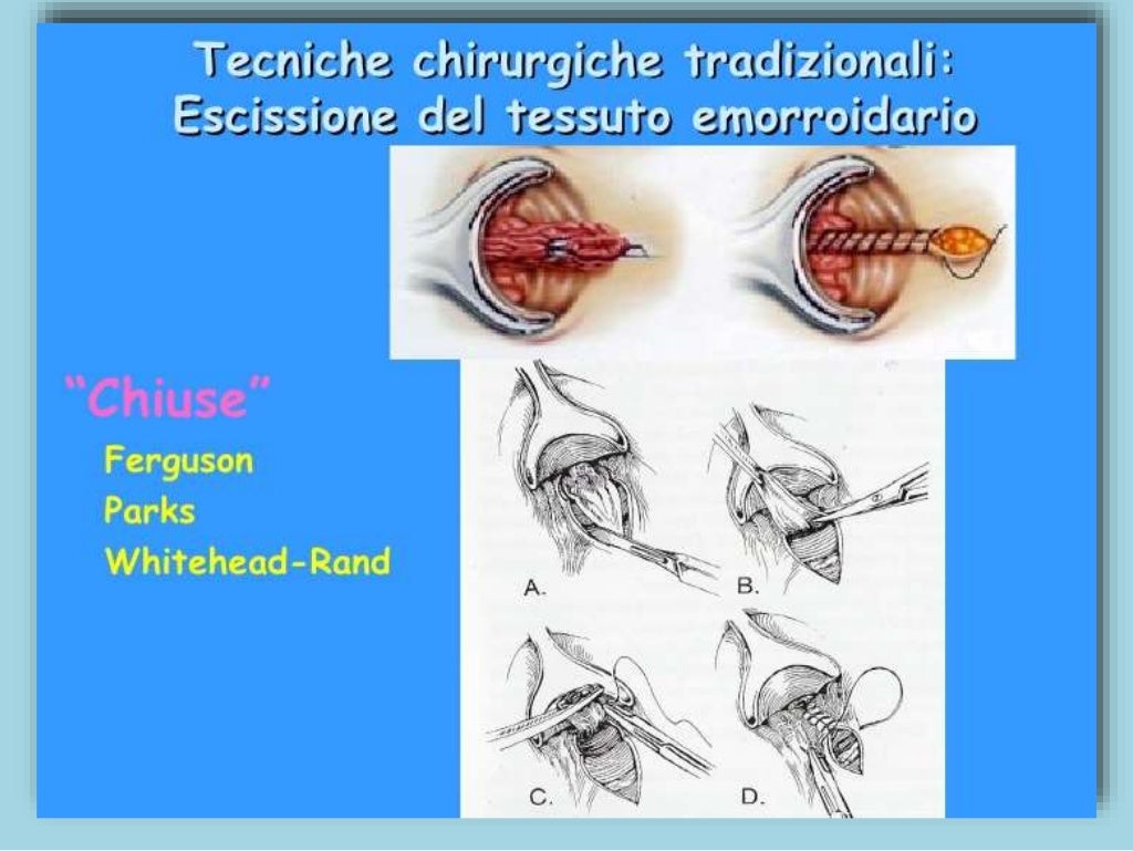 L'intervento di Milligan Morgan