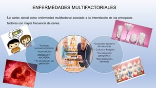 Etiología de la caries dental | PPTX