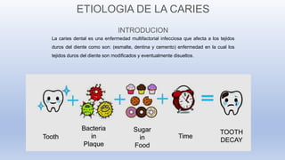 Etiología de la caries dental | PPTX