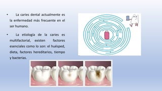 Etiología de la caries dental | PPTX