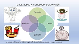 Etiología de la caries dental | PPTX