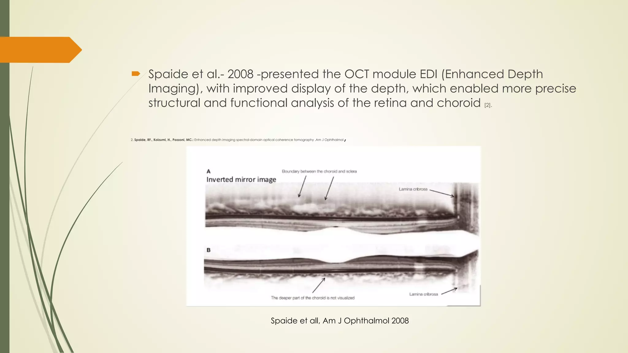 Andreea moraru pachychoroid spectrum of diseases | PDF