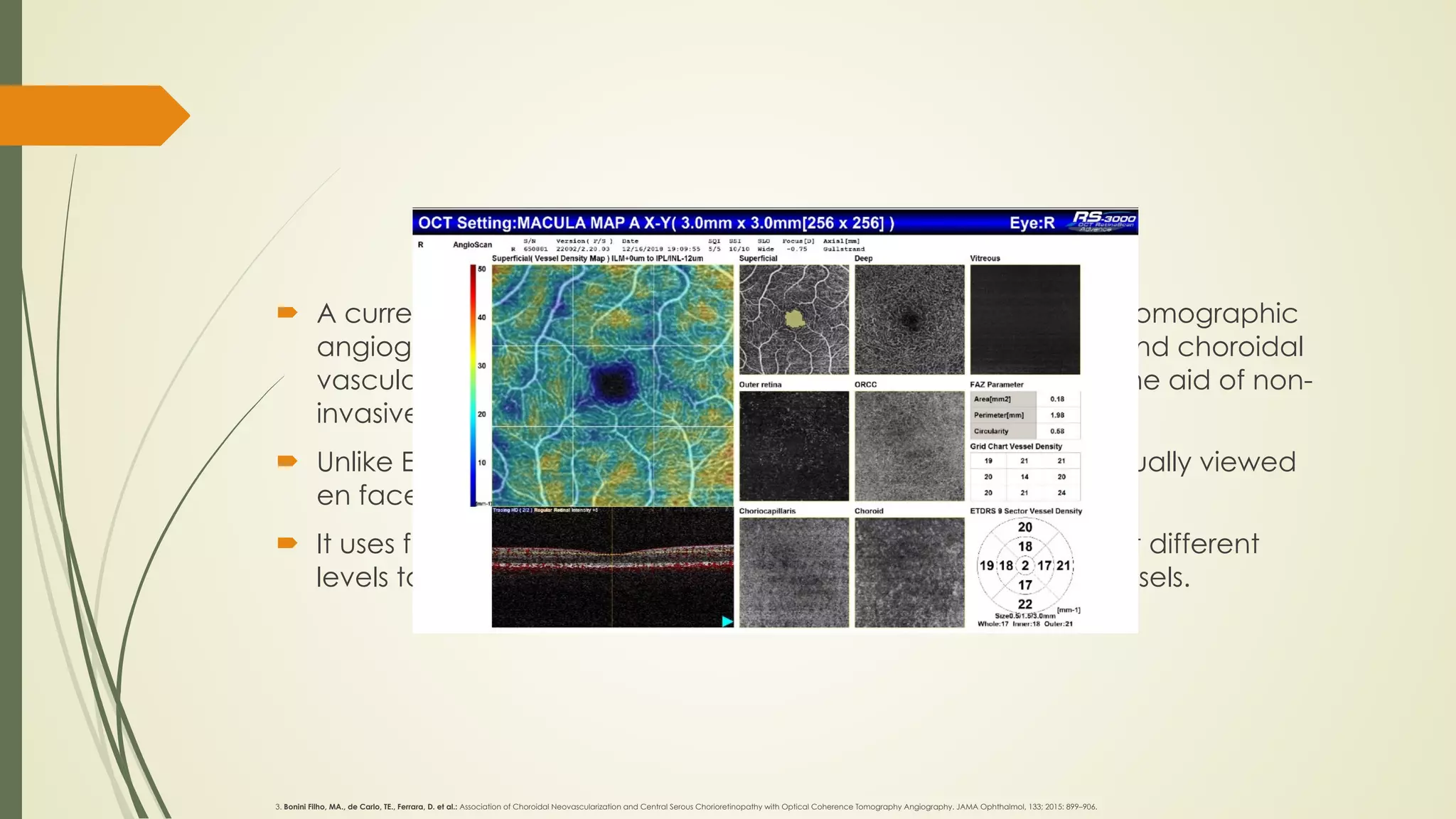 Andreea moraru pachychoroid spectrum of diseases | PDF