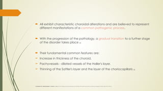 Andreea moraru pachychoroid spectrum of diseases | PDF