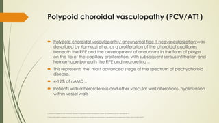 Andreea moraru pachychoroid spectrum of diseases | PDF