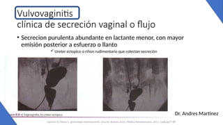 sangrado vaginal y leucorrea en paciente infaltil bajo contexto de ...