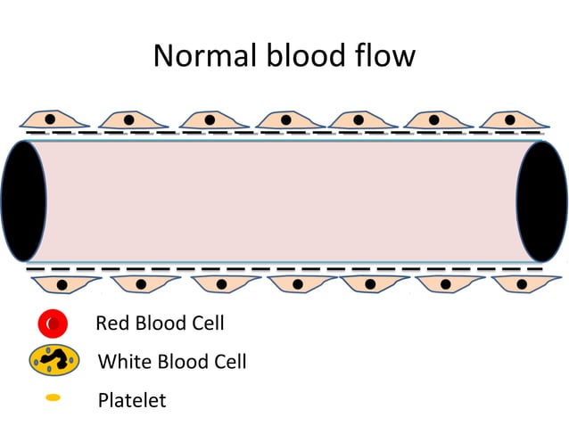Andrew Riordan @ MRF Childhood Amputee Day - Pushing the Boundaries | PPT