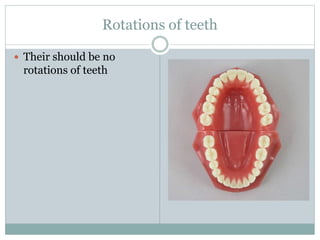 Andrew 6 keys of occlusion-1.pptx orthodontics | PPTX