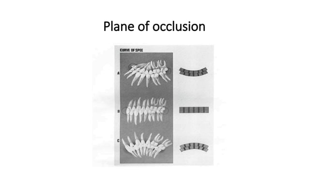 ANDREW'S 6 ELEMENTS OF OROFACIAL HARMONY PREPARED BY MBOWA.pptx