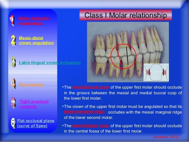 Andrews Six keys of occlusion Andrews Six keys of occlusion