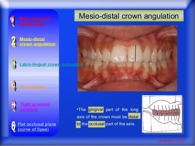 Andrews Six keys of occlusion Andrews Six keys of occlusion