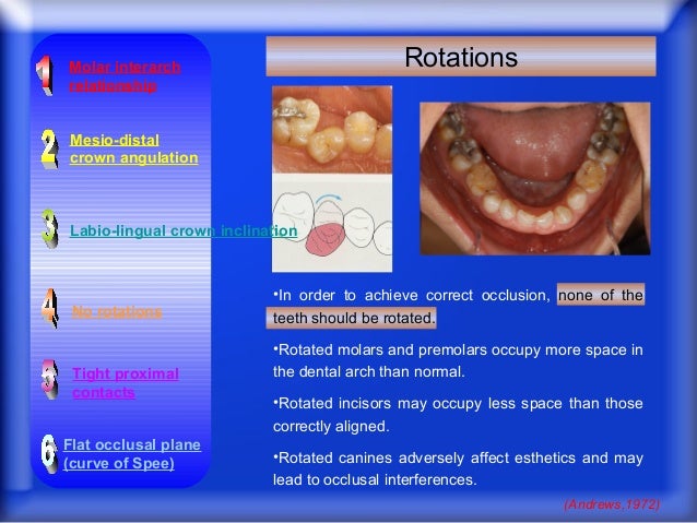 Andrews Six keys of occlusion Andrews Six keys of occlusion
