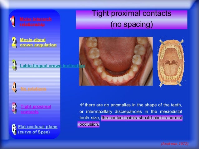 Andrews Six keys of occlusion Andrews Six keys of occlusion