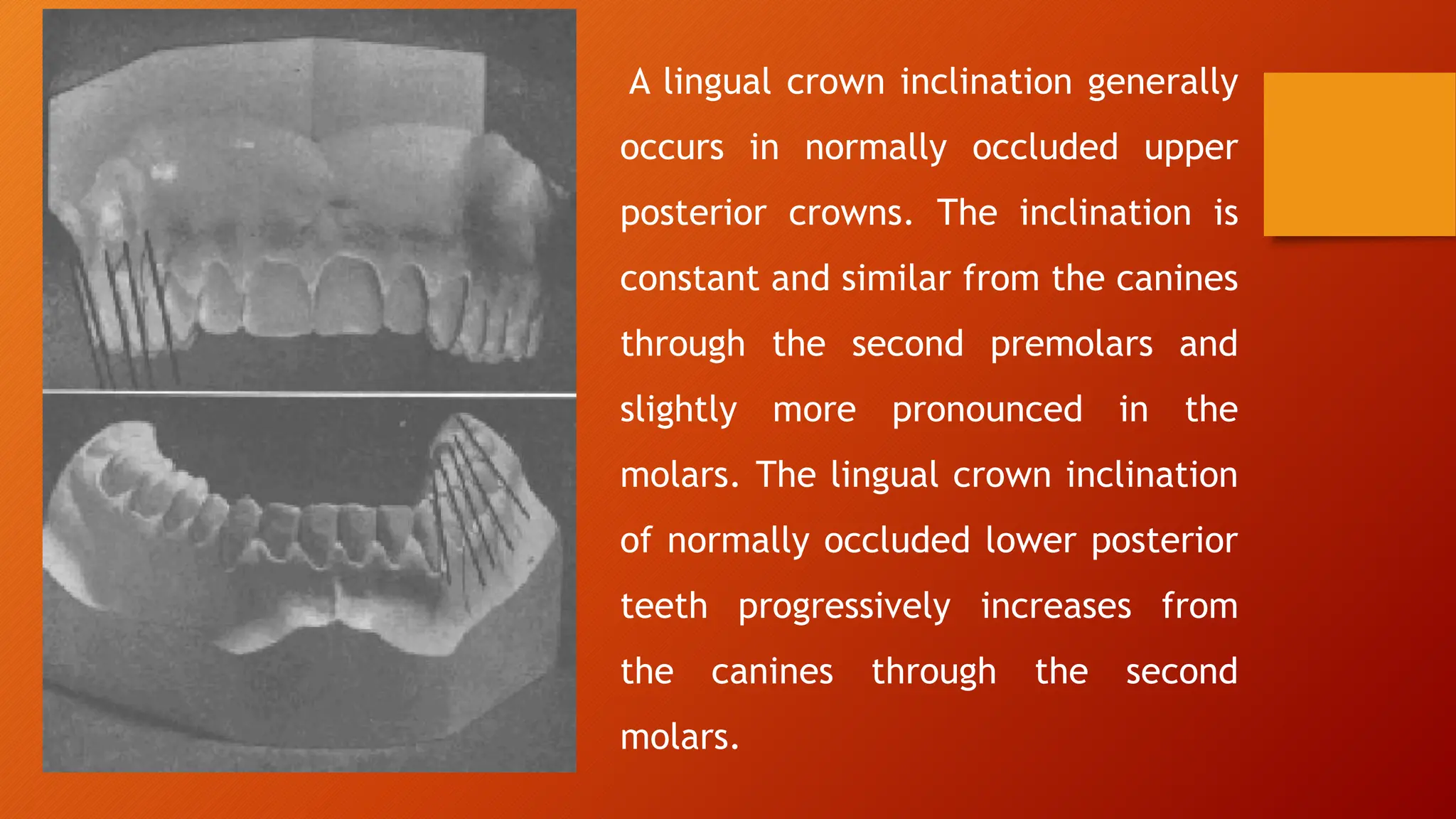 Andrews's six keys of ideal occlusion.pptx