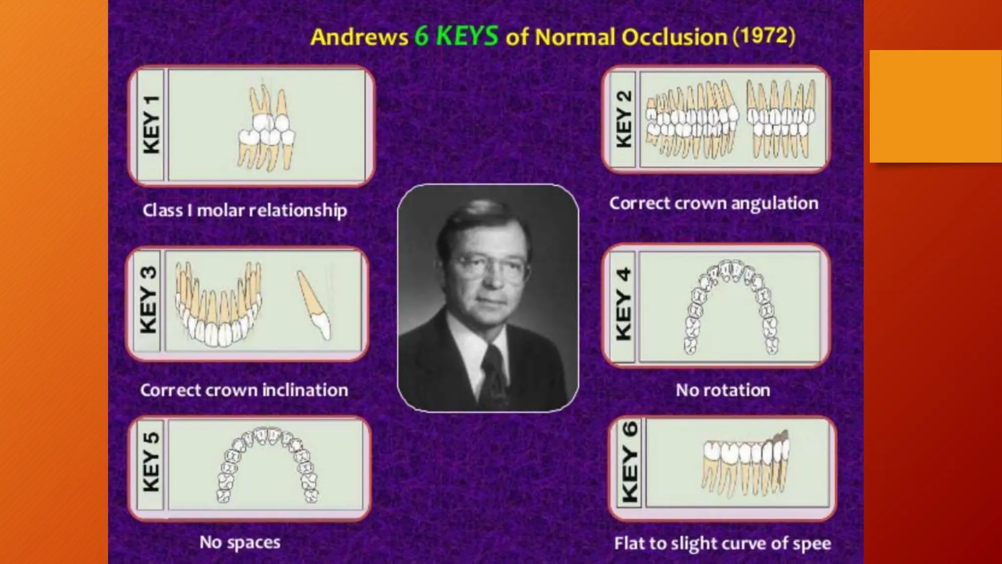 Andrews's six keys of ideal occlusion.pptx