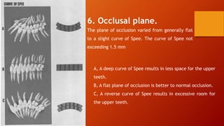 Andrews's six keys of ideal occlusion.pptx