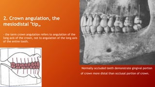 Andrews's six keys of ideal occlusion.pptx