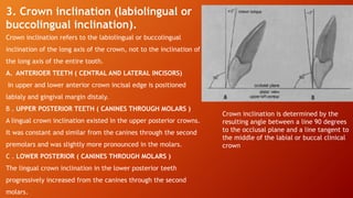 Andrews's six keys of ideal occlusion.pptx