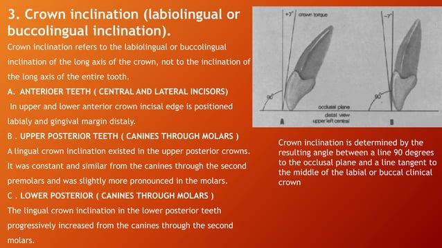 Andrews's six keys of ideal occlusion.pptx