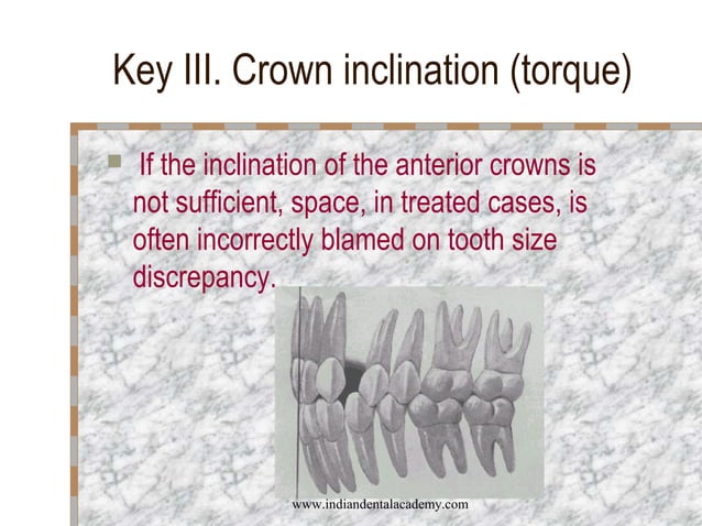 Andrews 6 Keys Of Normal Occlusion Certified Fixed Orthodontic Courses