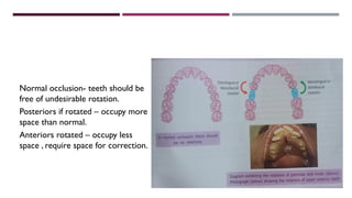 Andrews keys of occlusion in orthodontics | PPTX