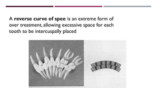 Andrews keys of occlusion in orthodontics | PPTX