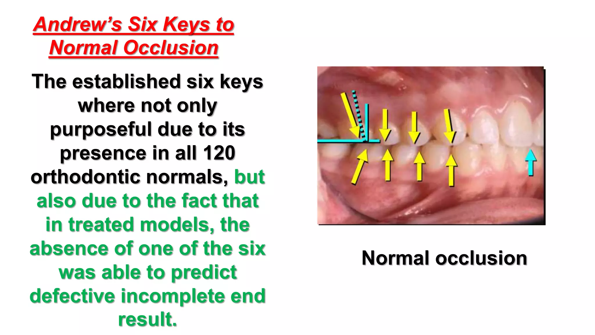 Andrew’s six keys of normal occlusion | PPTX