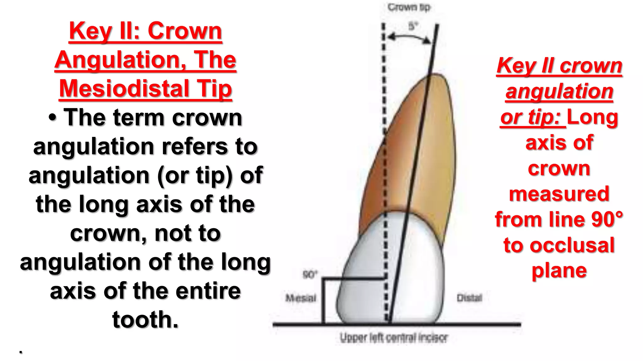 Andrew’s six keys of normal occlusion | PPTX