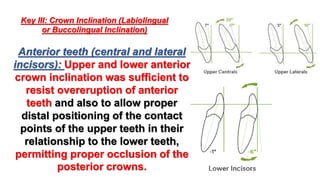 Andrew’s six keys of normal occlusion | PPTX