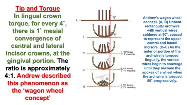 Andrew’s six keys of normal occlusion | PPTX | Dental Health | Diseases ...