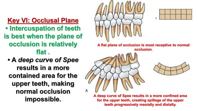 Andrew’s six keys of normal occlusion | PPTX | Dental Health | Diseases ...