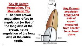 Andrew’s six keys of normal occlusion | PPTX