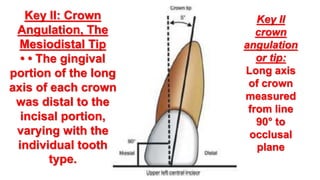 Andrew’s six keys of normal occlusion | PPTX
