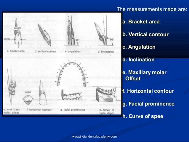 Andrews six keys of occlusion