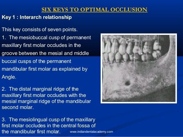 Andrews six keys of occlusion