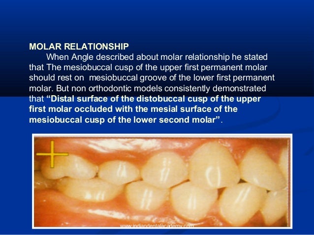 Andrews six keys of occlusion